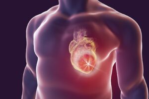 Heart Symptoms of Myocarditis | Myocarditis UK